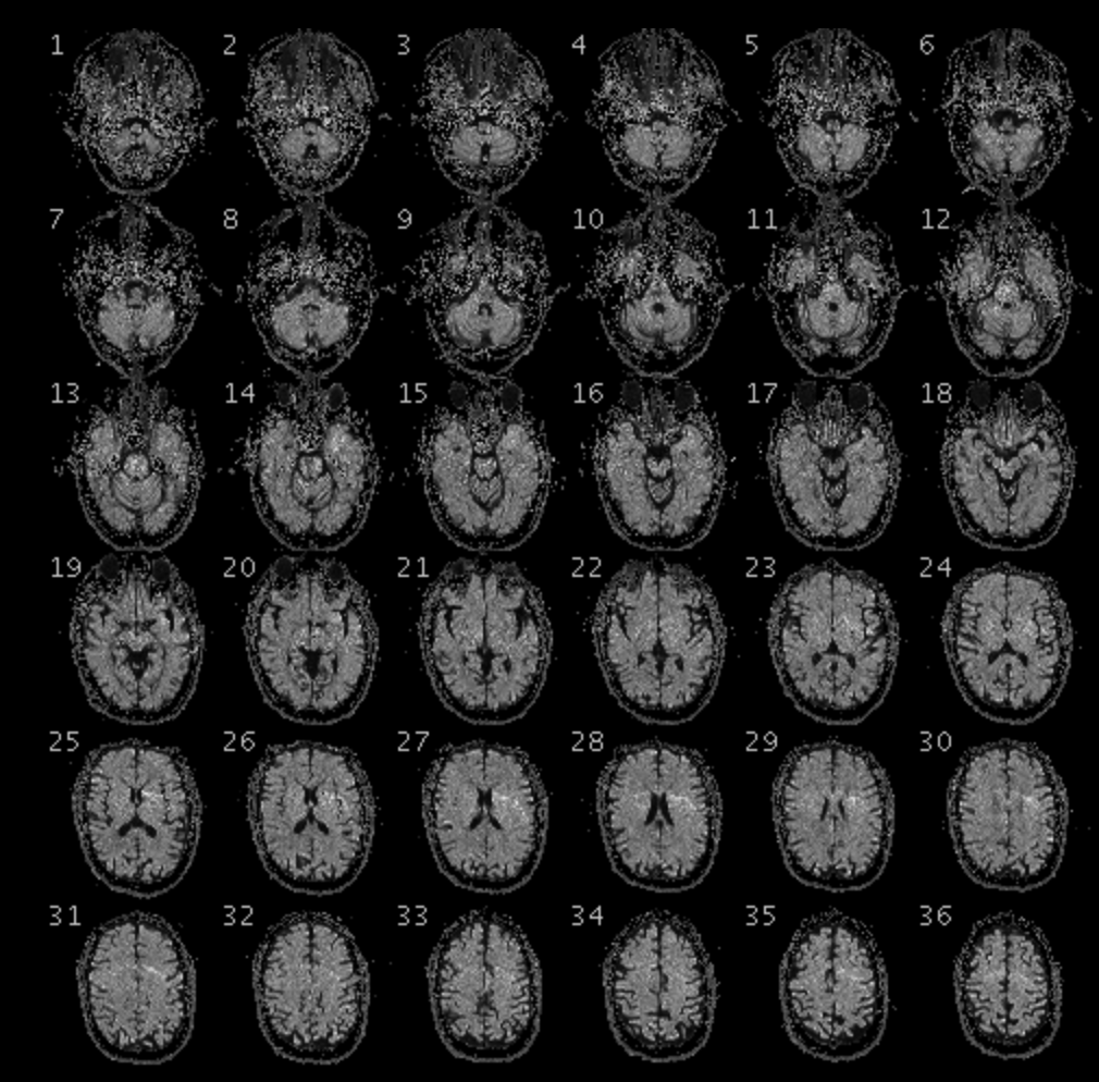 IntroductioDeciphering cognitive processes using NeuroImaging ...